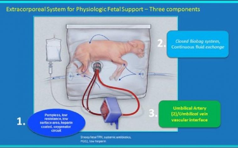 Scientist Create An Artificial Placenta That Works And Could Provide A ...